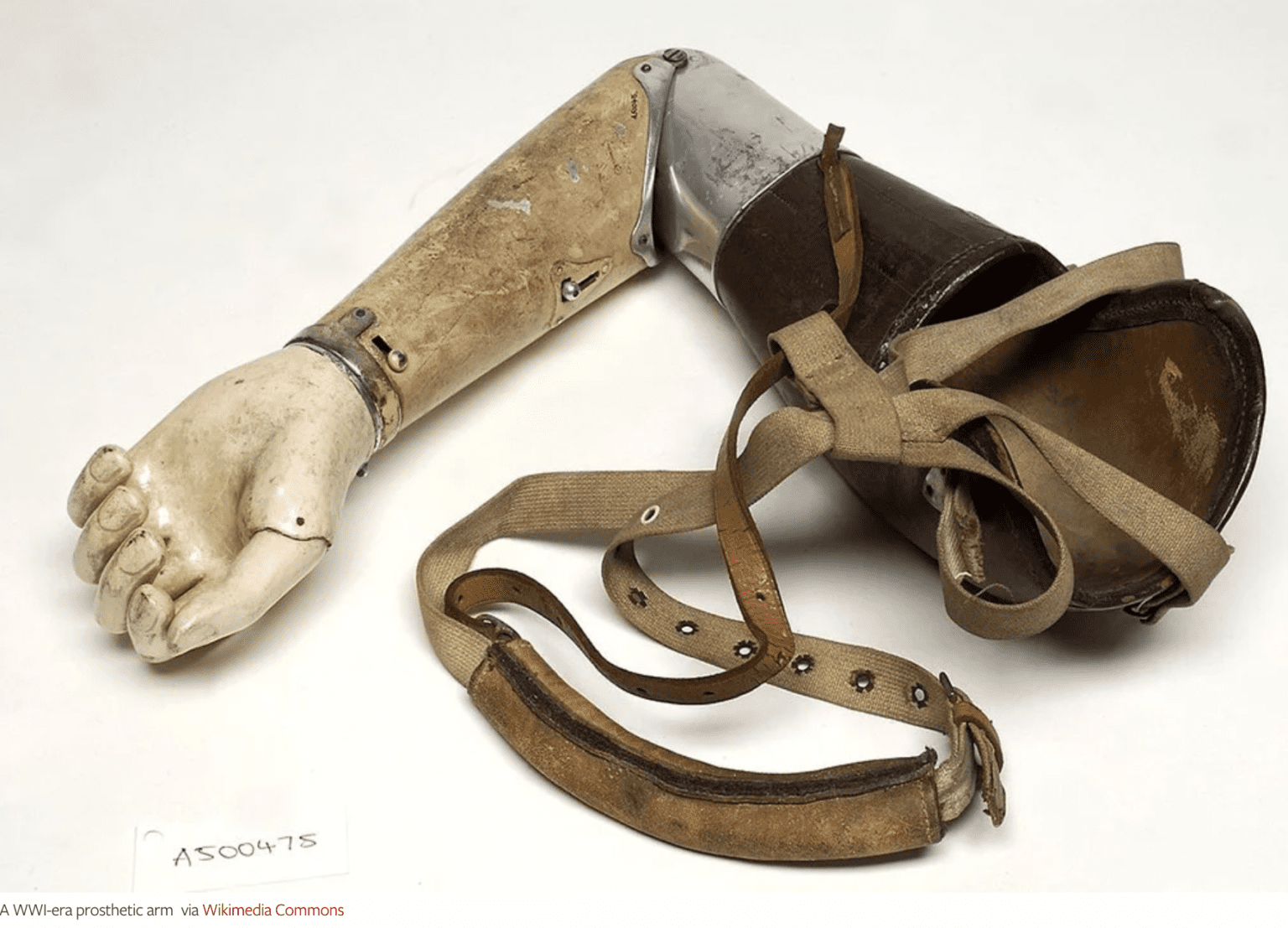 Limb Loss Awareness Month: Advancements in Prosthetics and Resources ...